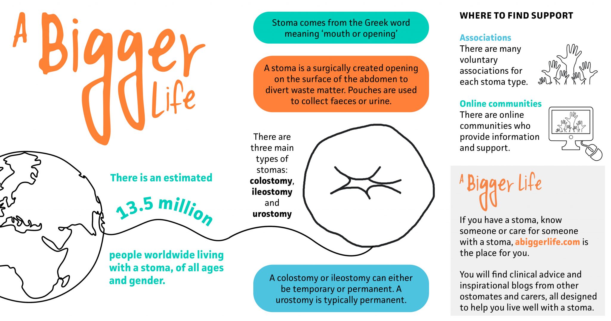 What is a stoma? - A Bigger Life